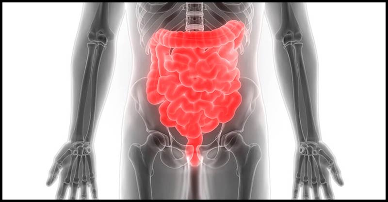How To Protect Our Colon | Dr Farrah MD