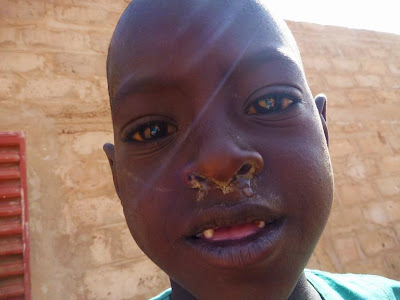 mraux: funny ugly babies