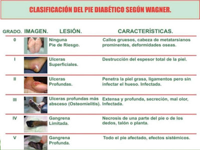 Clasificación de Wagner del pie diabético - Dr. Pies