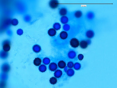 Fun With Microbiology (What's Buggin' You?): Sepedonium species