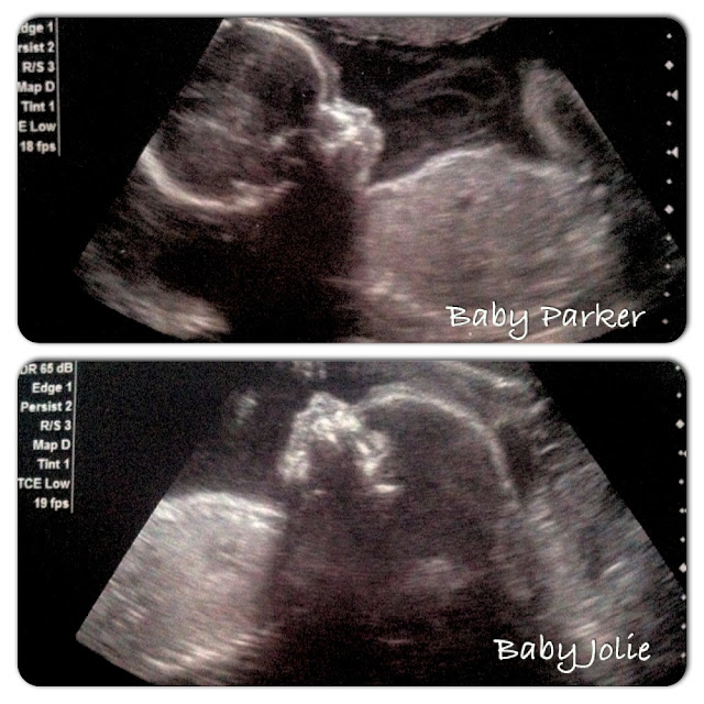 PB+J Babes: 26 Weeks + Baby Update