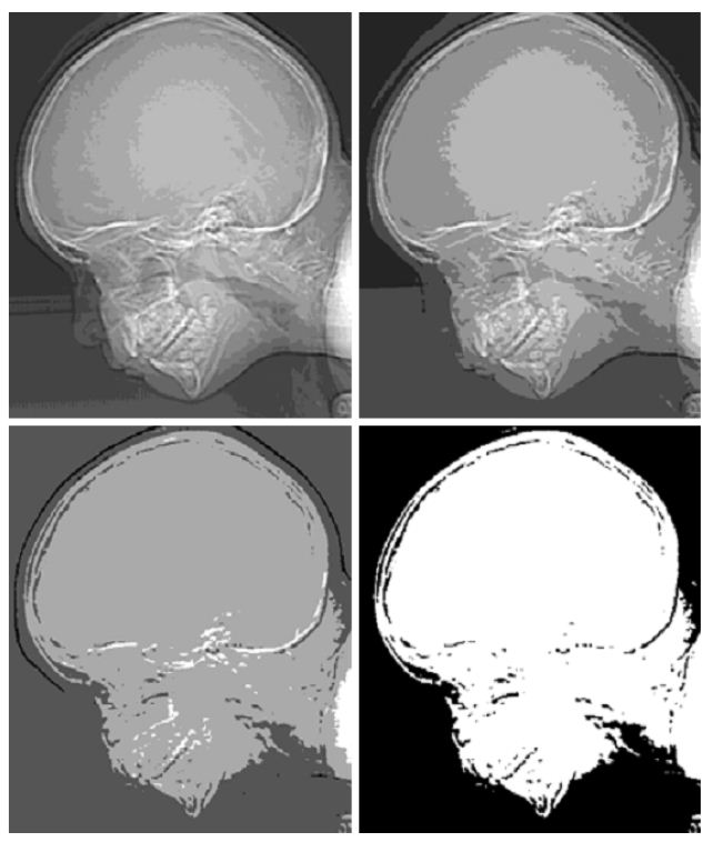 7. Define spatial and gray level resolution. Explain about ...