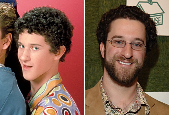 Dustin Diamond Plastic Surgery
