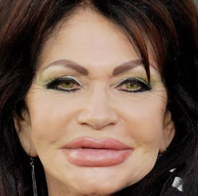 TechDaddyTech: Victims of plastic surgery (38 photos)