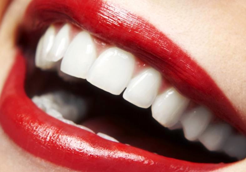 Vitácea Odontologia: 7 técnicas para ganhar dentes mais bonitos