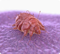 Épidémie : La gale fait son grand retour dans nos régions