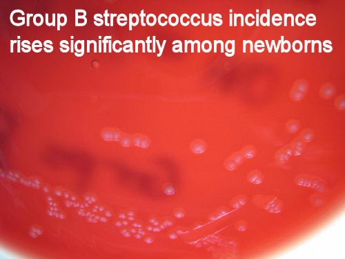 Medical Laboratory and Biomedical Science: Group B streptococcus ...