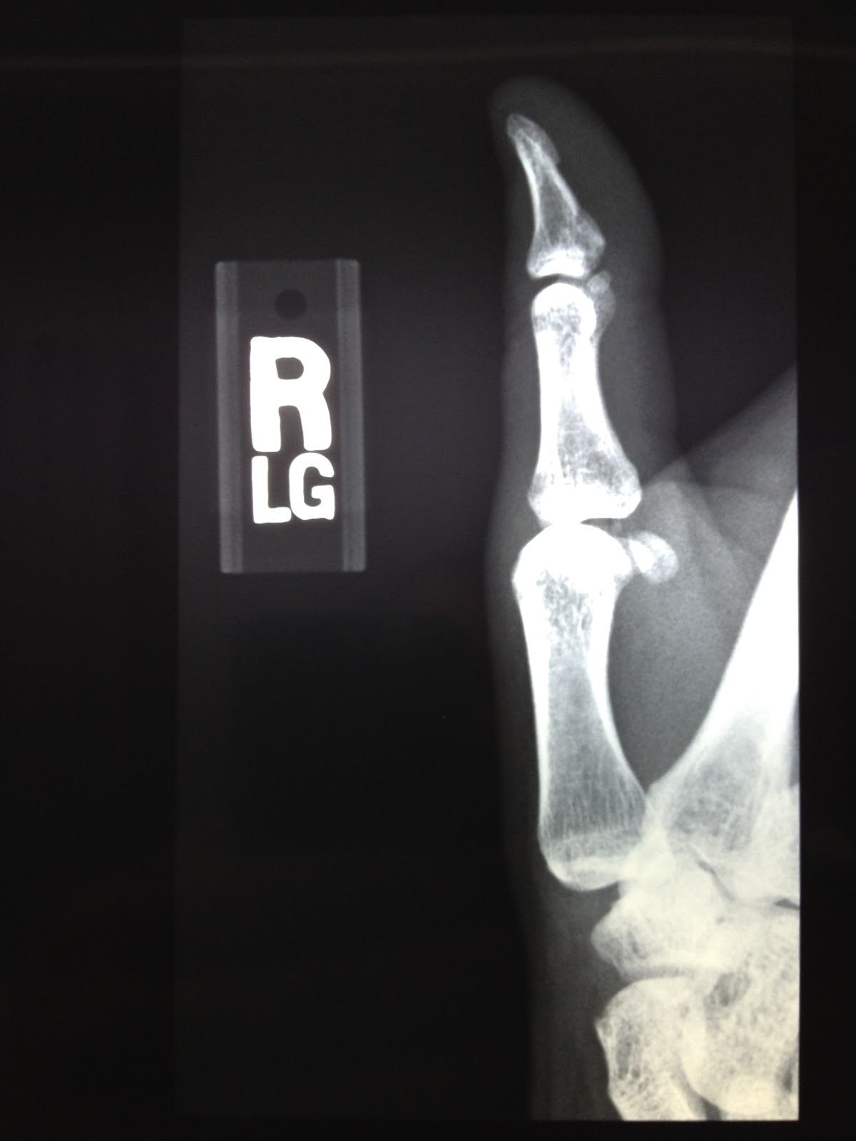 The Paleo Lounge: 1,2,3,4, I declare a thumb war