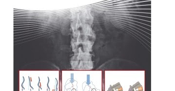 AOSpine Masters Series