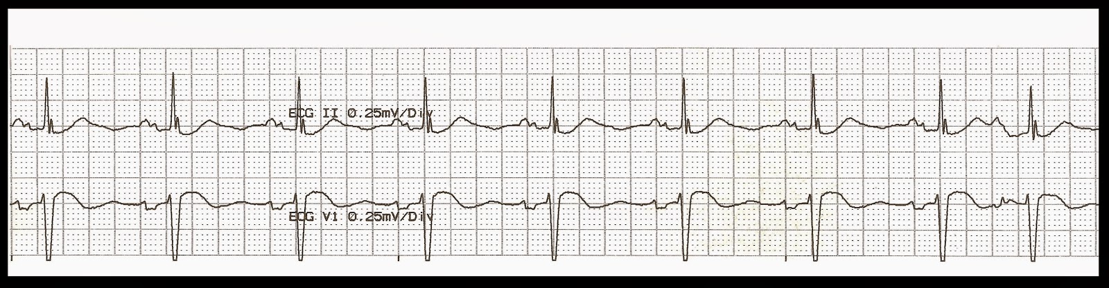 Practice EKG Strips 340