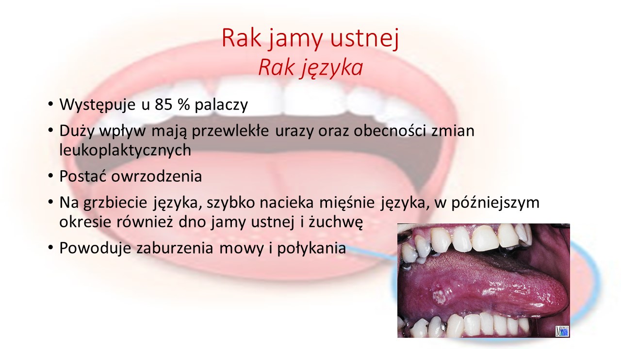 Stomatologia dla profesjonalistów: lipca 2015
