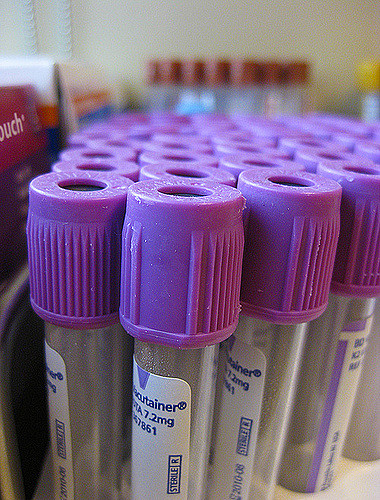 Love That Max A Blood Test For Autism The Good And The Bad love-that-max-a-blood-test-for-autism-the-good-and-the-bad