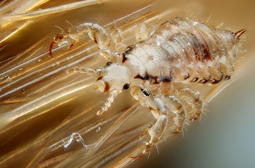 Head Lice Signs and Symptoms | Health Topica