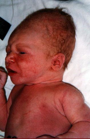 4 Mamas: What Do Newborns Really Look Like?