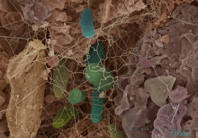 Of Bacteria and Men: A view of microbial life in soil