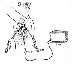 TORACOTOMIA Y TORACOCENTESIS