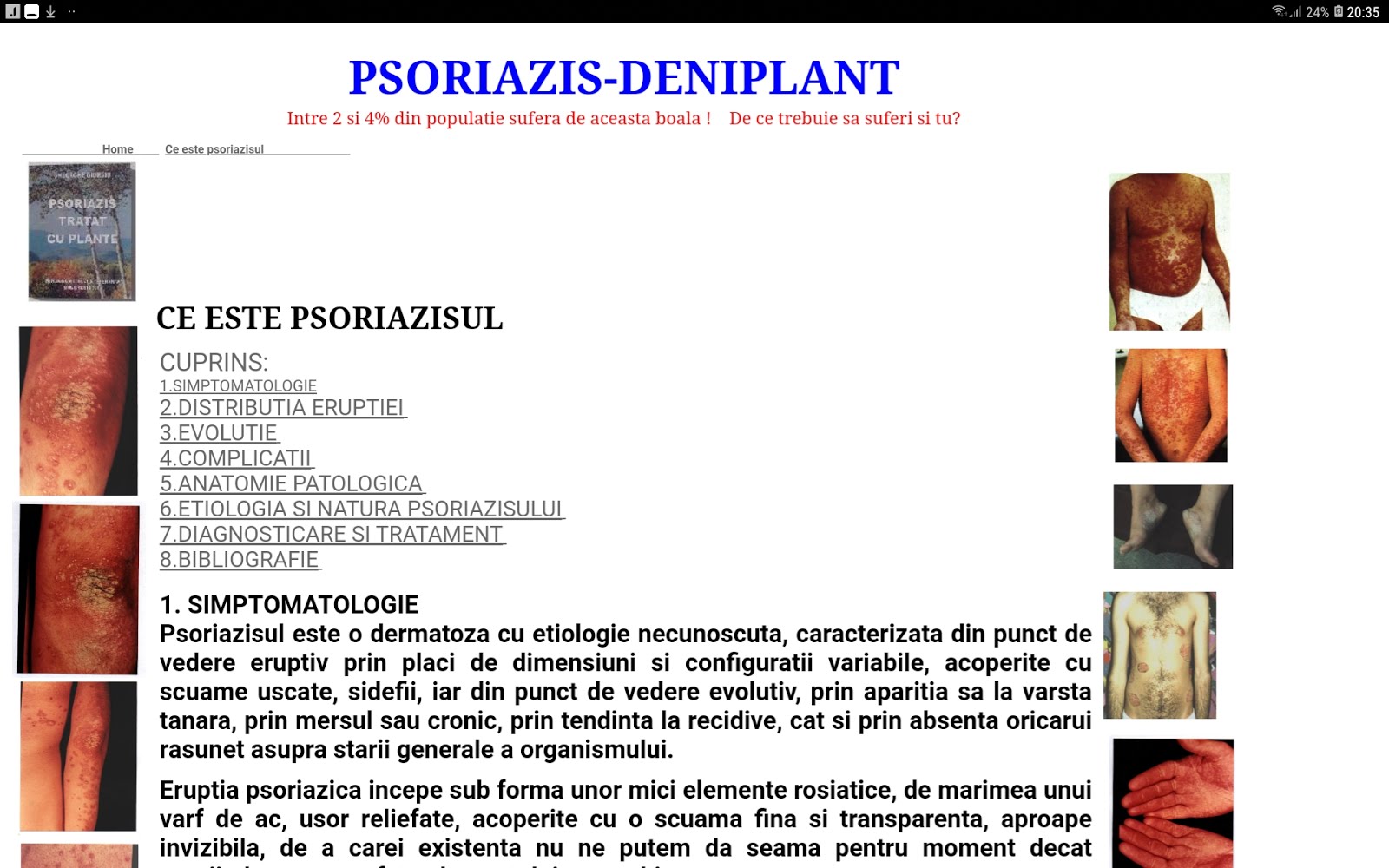 PSORIAZIS-CORESPONDENTA DENIPLANT: Psoriazisul boala genetica vindecata ...