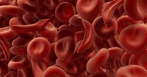 Drépanocytose définition , causes et symptômes | livres scientifiques