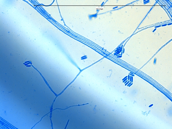 Fun With Microbiology (What's Buggin' You?): Sarocladium kiliense