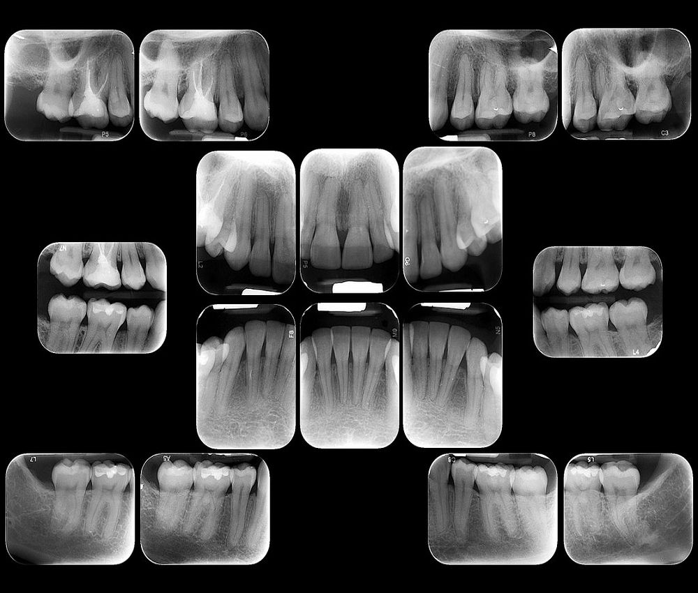 Radiologia Odontológica : Exame Radiográfico - Conceitos iniciais