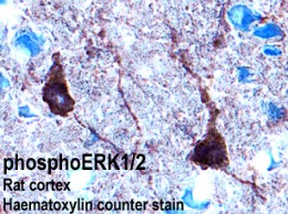 Neuromics: Perky ERKies and Depression