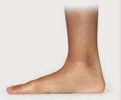 KinetoPro: Exerciții pentru picior plat