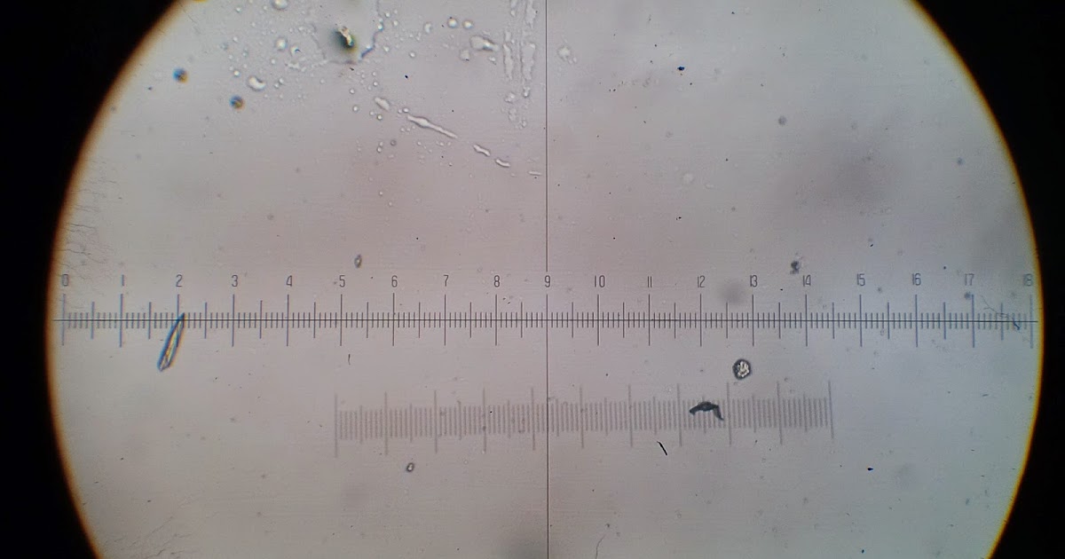 Lab IBG102: Lab 2: Measurement and Counting of Cells Using Microscope
