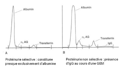 SYNDROME NEPHROTIQUE - BIOLOGIE MEDICALE