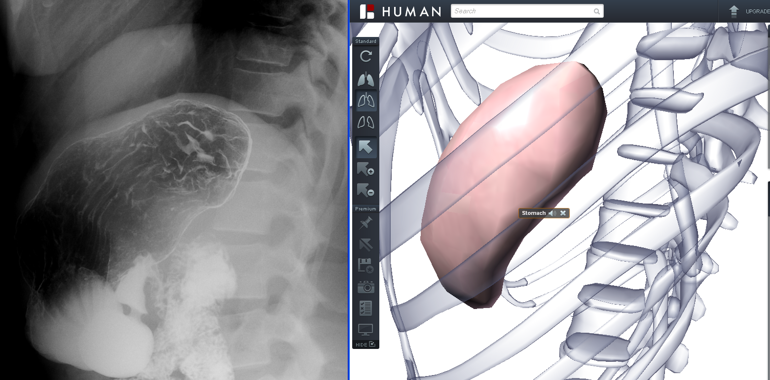 Topics in Radiography: UGI Image Evaluation