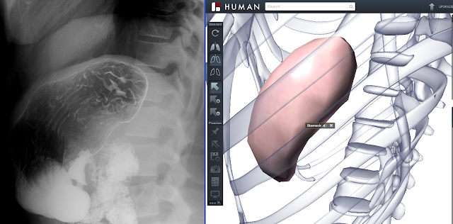 Topics in Radiography: UGI Image Evaluation