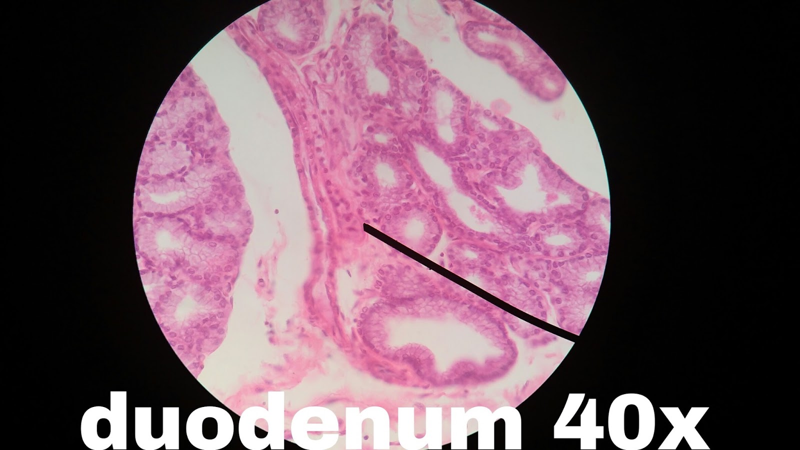 THEONEDESTINY: Duodenum Histology