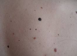 SEMIOLOGÍA QUIRURGICA: Cabeza y Cuello