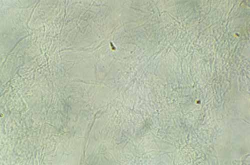 [Haematology] Microscopic Examination of Urinary Sediment - MISCELLANEOUS STRUCTURES | Free ...