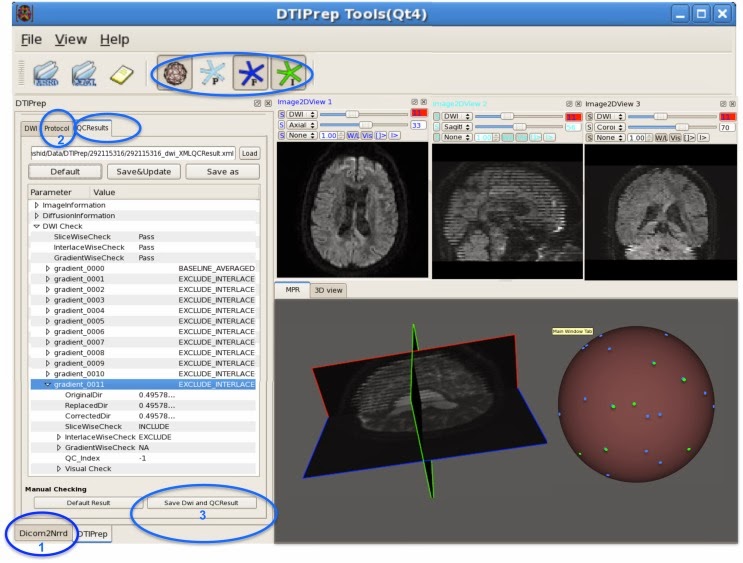 DTI Quality Control - Part 3: Tools | Diffusion Imaging; Introduction, tutorials and background ...
