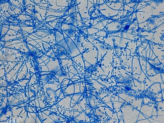 Trichophyton; Endodermophyton