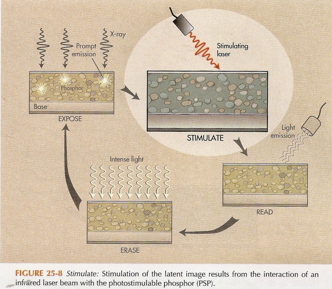 Radiodiagnostik Pemula: Komputer Radiologi (CR)