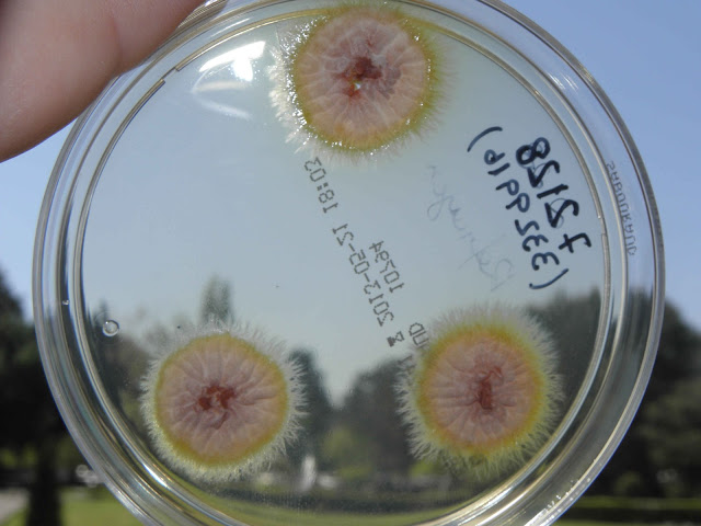 ATLAS MICOLOGIA: TRICHOPHYTON SOUDANENSE