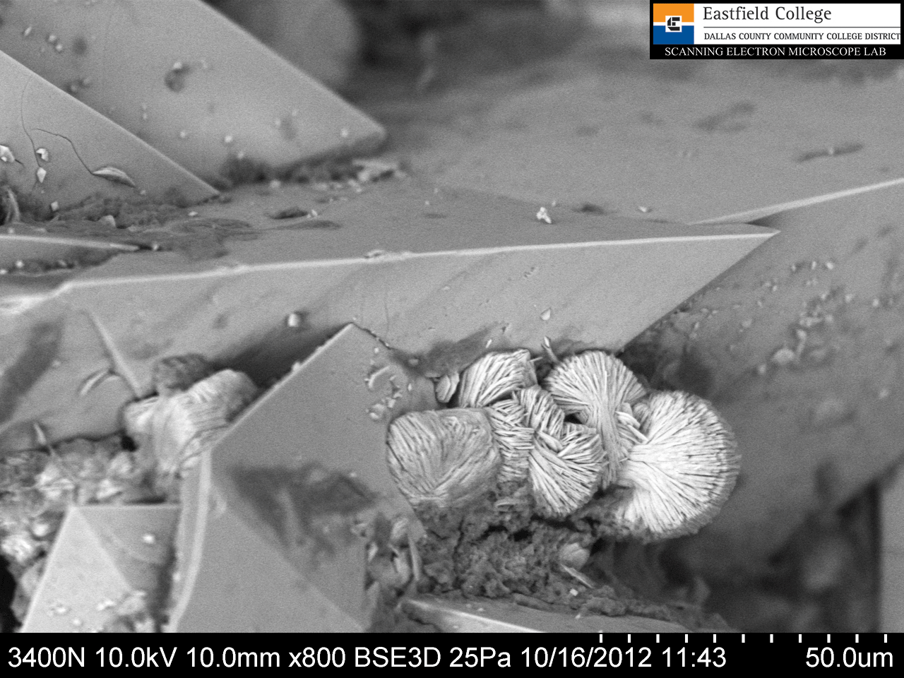 Scanning Electron Microscope Blog: A Kidney Stone - OUCH!!