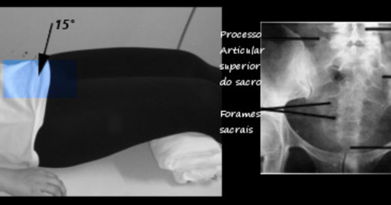 Sacro Coccix- AP Axial