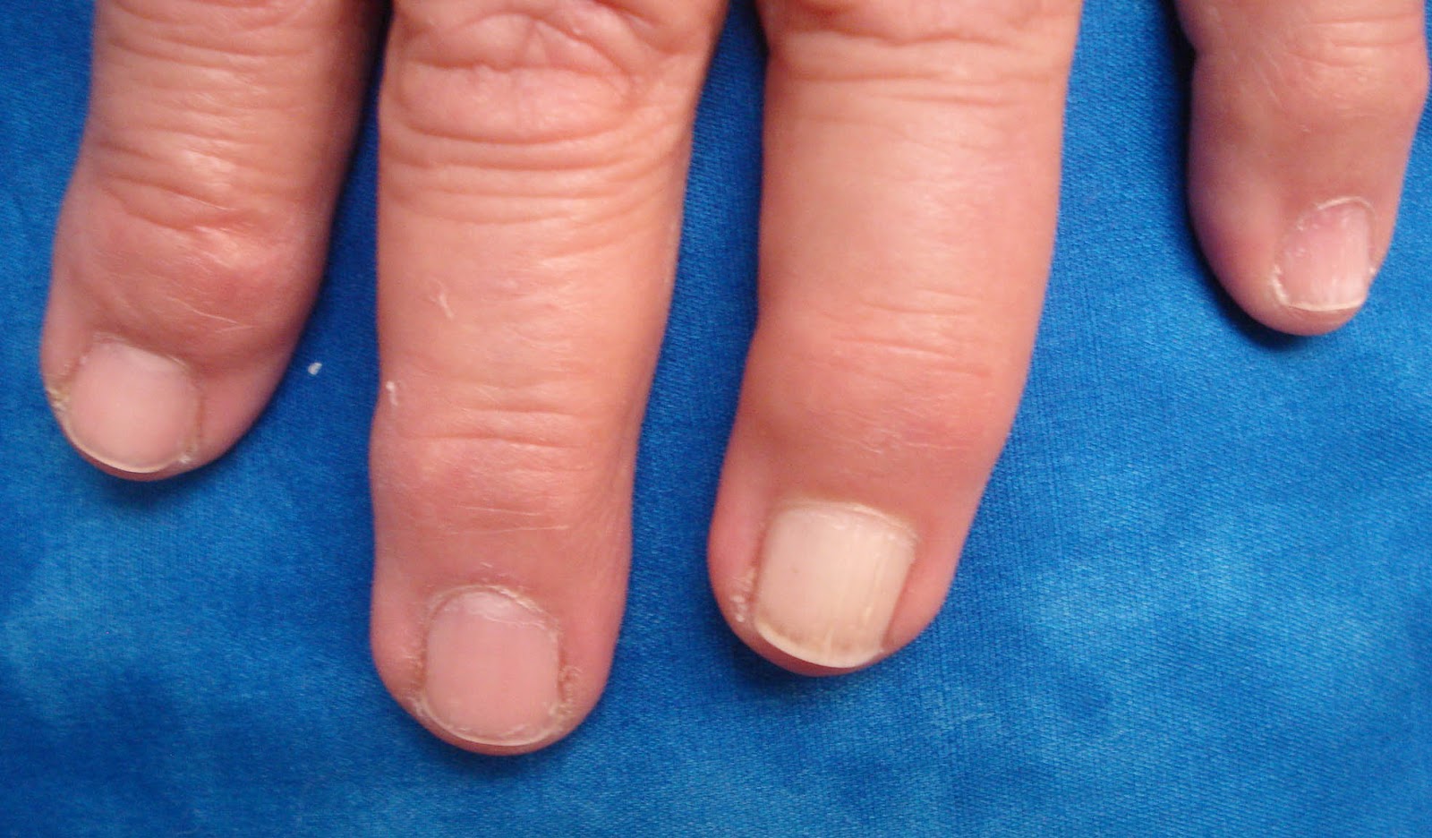 VIRTUAL GRAND ROUNDS IN DERMATOLOGY 2.0: July 2017