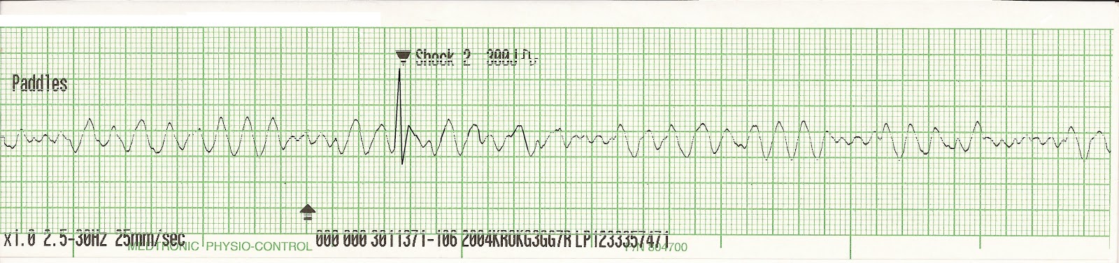 Electrical Interventions