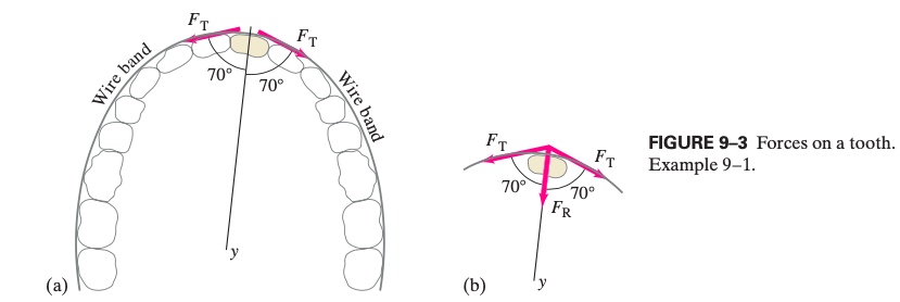 Physics 111: Fundamental Physics I: Physics and Braces