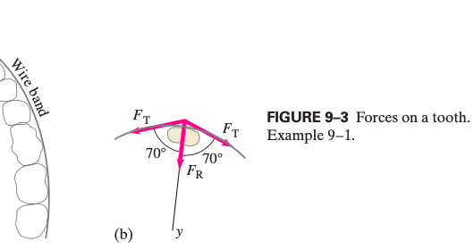 Physics 111: Fundamental Physics I: Physics and Braces
