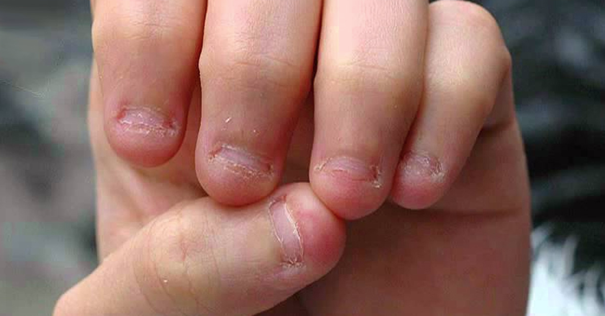 Невероятно но факт: Did you know 60% of people chew their nails\\Знаете ...
