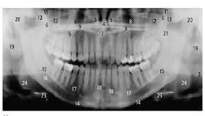 RADIOGRAFI : Teknik, Prinsip Umum Interpretasi, Efek Samping Radiasi ...