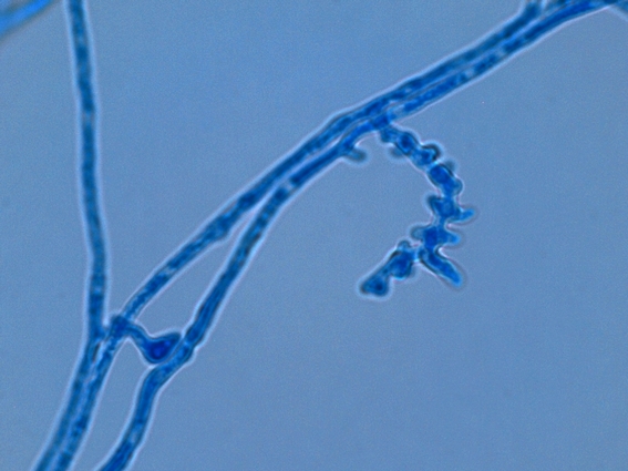 Fun With Microbiology (What's Buggin' You?): Microsporum audouinii