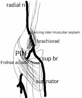 POSTERIOR INTEROSSEOUS NERVE SYNDROME - DNB Orthopaedics MS Orthopedics ...