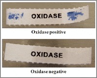 Lab series# 15: Biochemical tests for identification of bacterial isolates