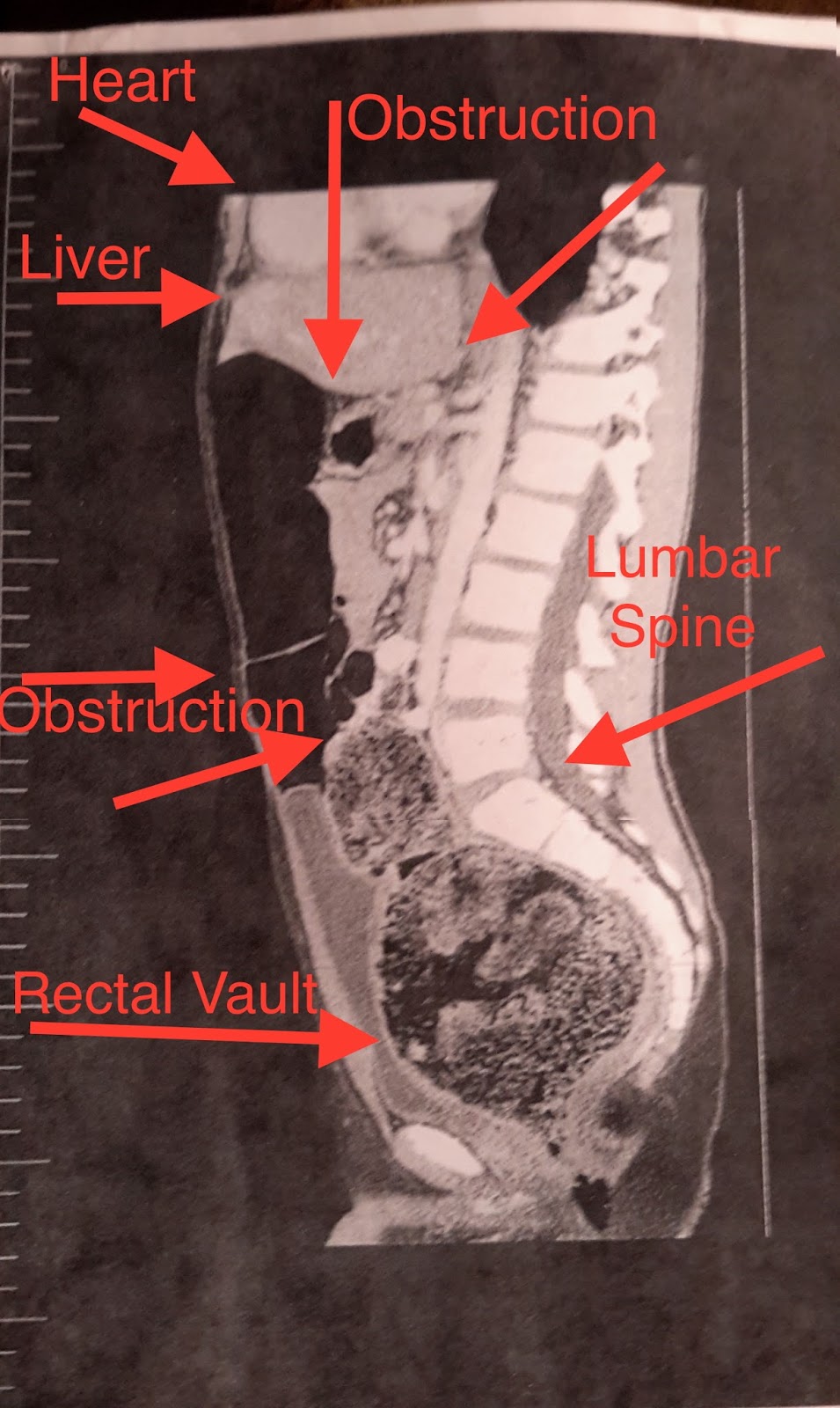Spydra's Web: February 2016