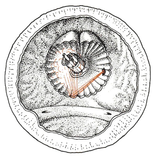 How to perform TURP? (post) step-by-step operative urology series